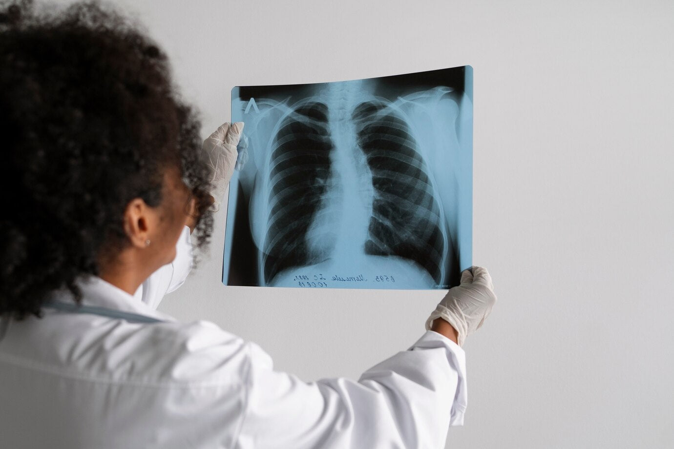 Diabetes Relacionada con la Fibrosis Quística: Conexiones y Cuidados ...